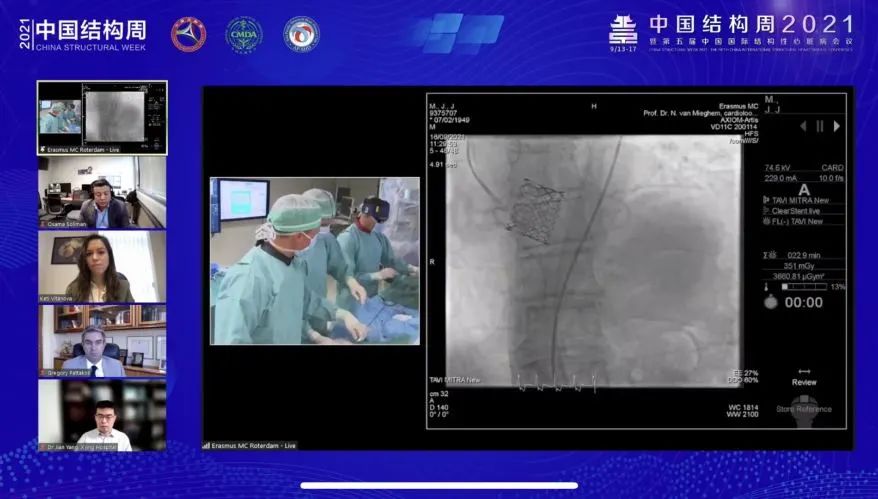 中国结构周2021｜国际频道第四日回归TAVR经典话题，共话复杂TAVR的现在与未来 -- 严道医声网