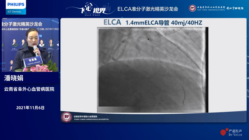 飞心视界｜飞利浦ELCA准分子激光精英沙龙会成功举办 -- 严道医声网