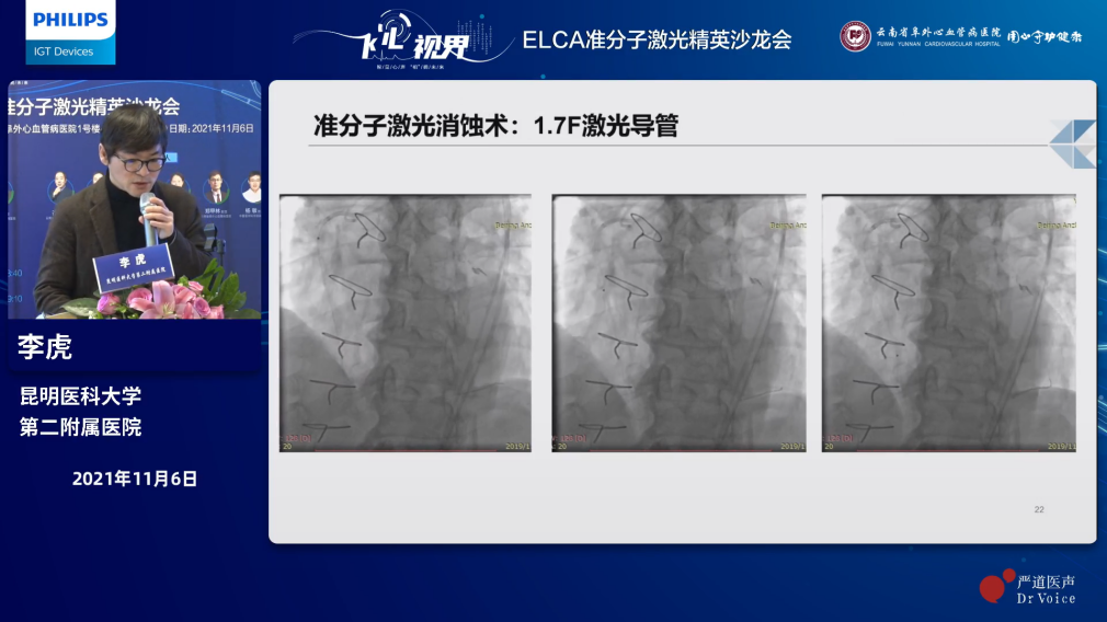 飞心视界｜飞利浦ELCA准分子激光精英沙龙会成功举办 -- 严道医声网