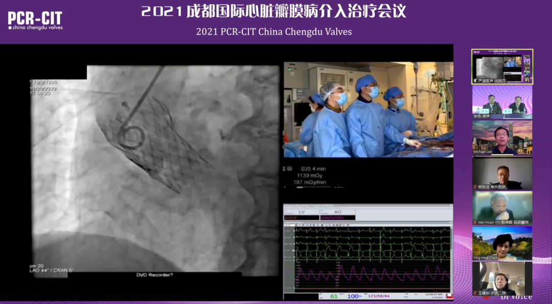 PCRCCV 2021 | 美敦力Evolut PRO TAVR获批上市后首次亮相 -- 严道医声网